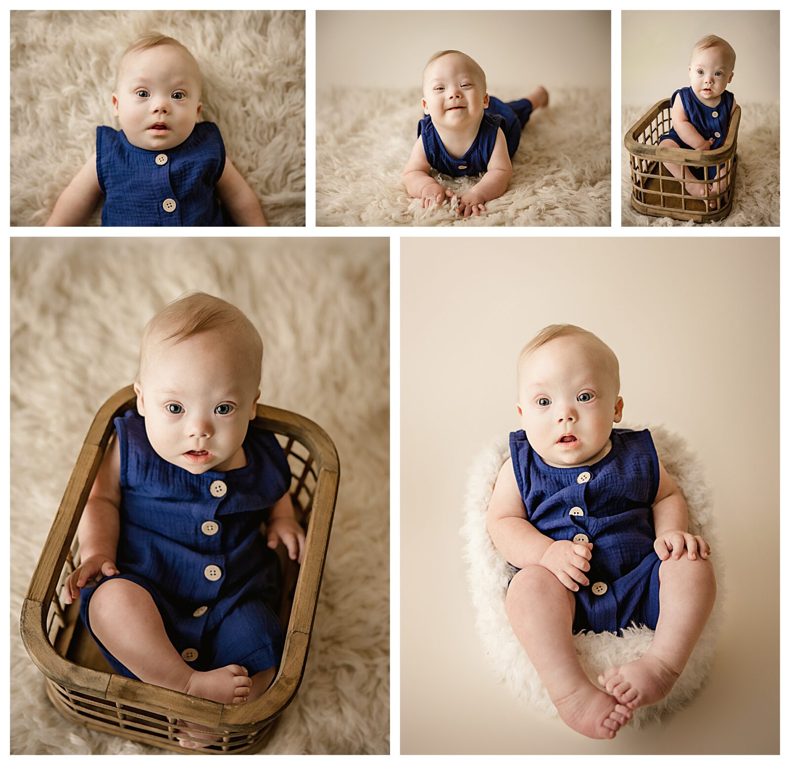 Promoting inclusion and support for individuals with Down Syndrome