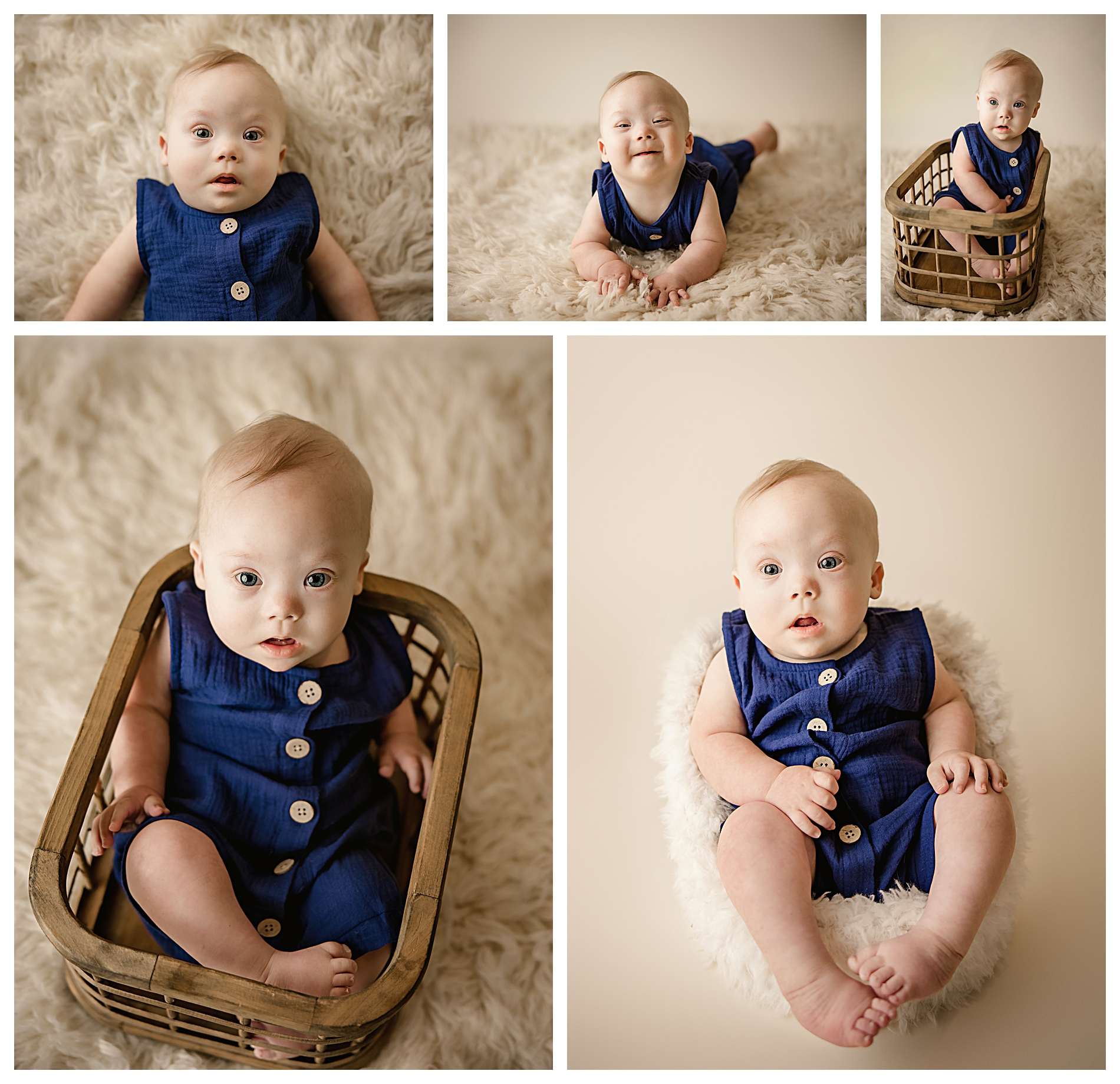 Promoting inclusion and support for individuals with Down Syndrome